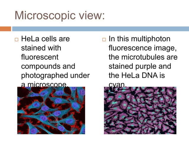 Henrietta Lack | PPTX