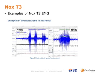 Henry Schein dental nox t3 presentation current | PPTX