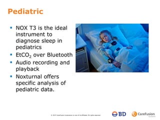 Henry Schein dental nox t3 presentation current | PPTX