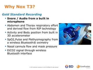 Henry Schein dental nox t3 presentation current | PPTX