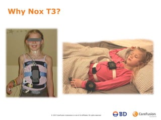 Henry Schein dental nox t3 presentation current | PPTX