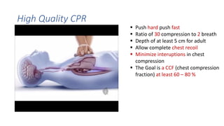 HENTI JANTUNGPPTWEBINAR.pptx