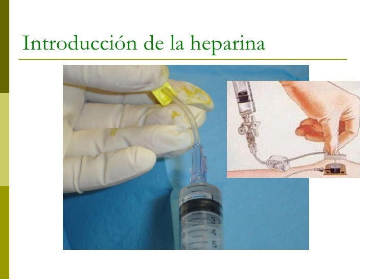 Heparinización de un Catéter tipo Reservorio