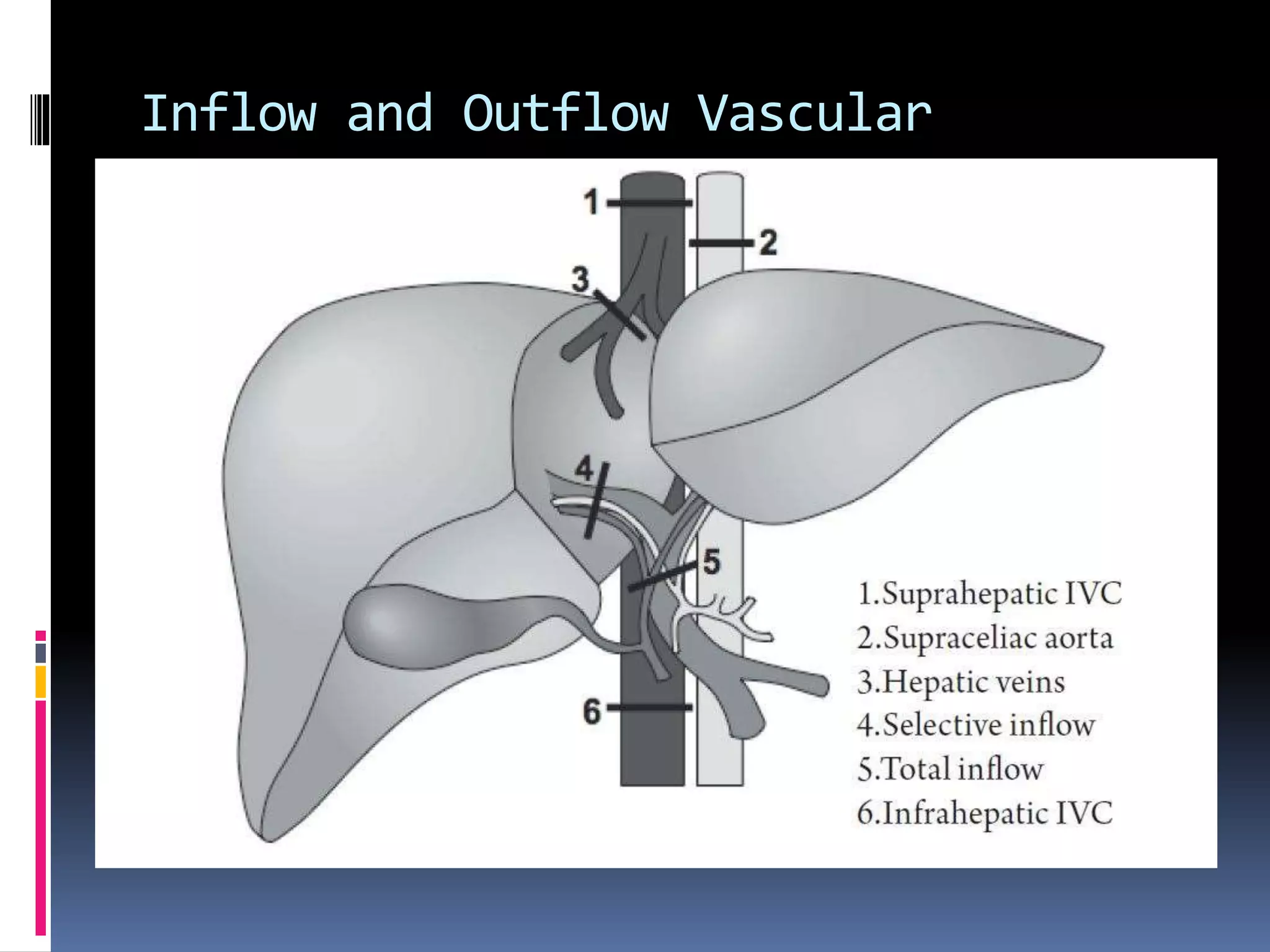 Hepatectomy anaesthesia | PPTX