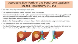 Hepatectomy | PPTX