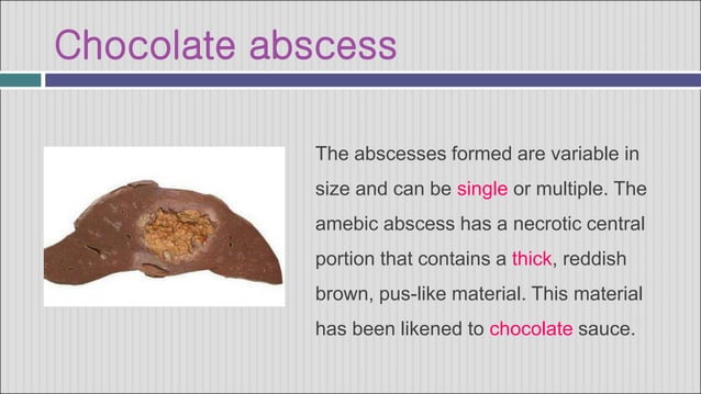 【中医药】Hepatic Abscess.ppt