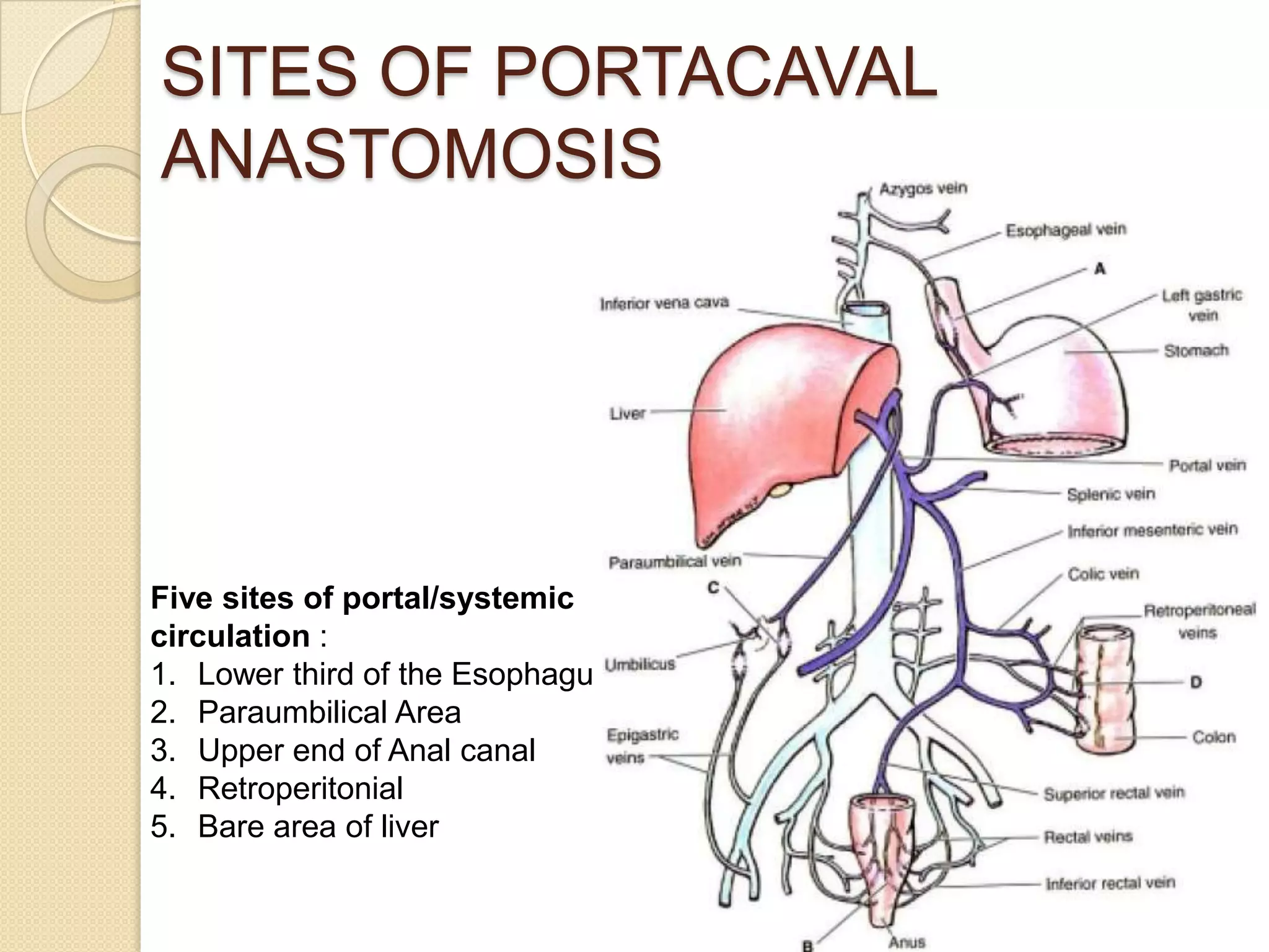 Portacaval Anastomosis | PPTX