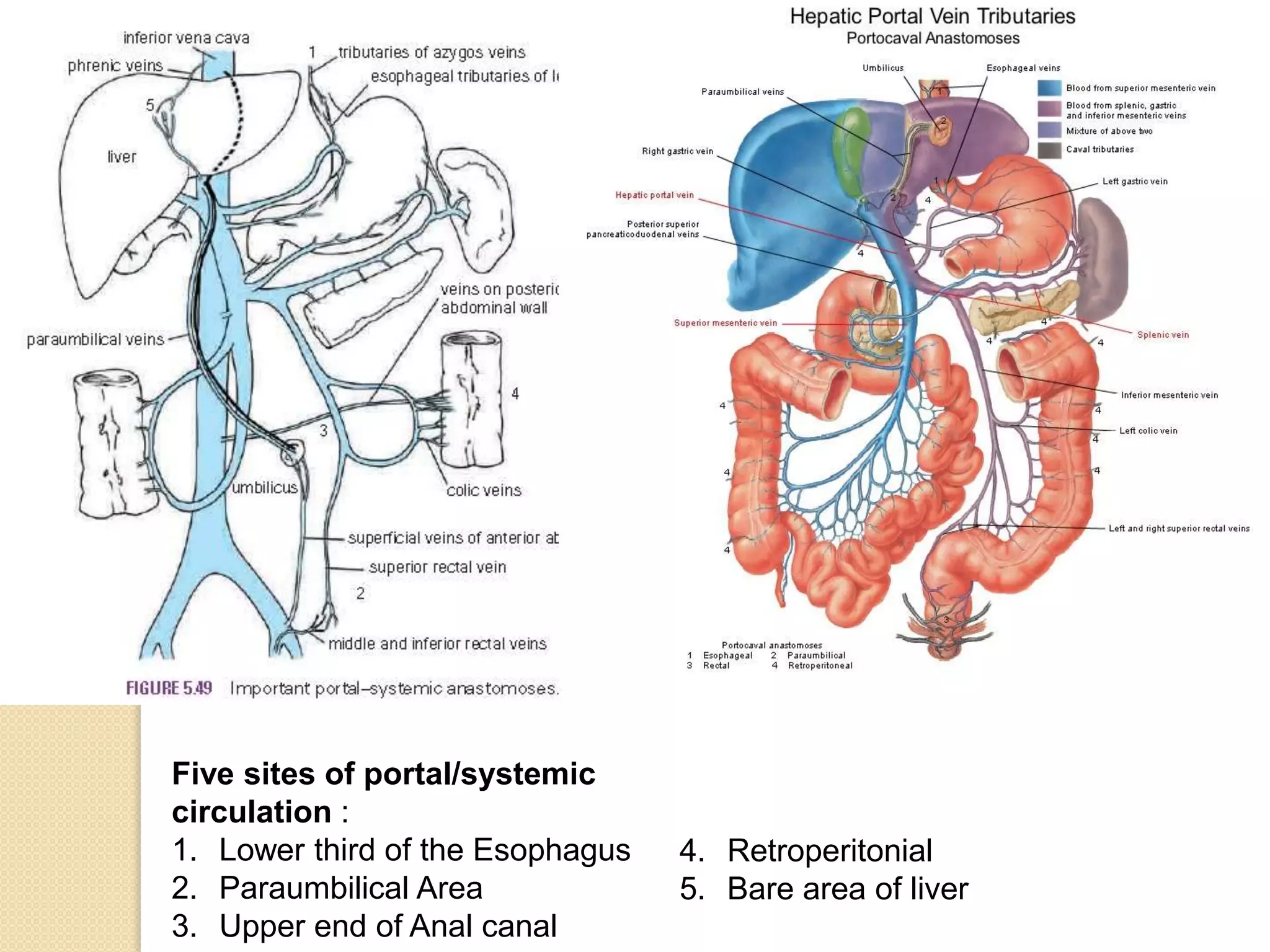 Portacaval Anastomosis | PPTX