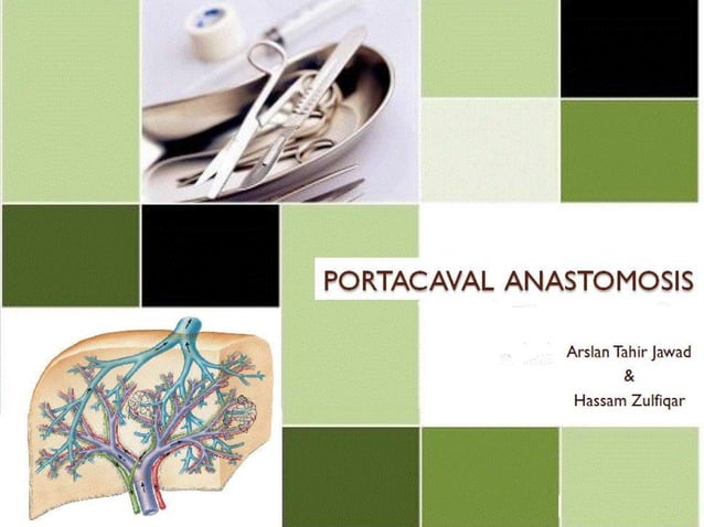 Portacaval Anastomosis | PPTX | Blood Disorders | Diseases and Conditions