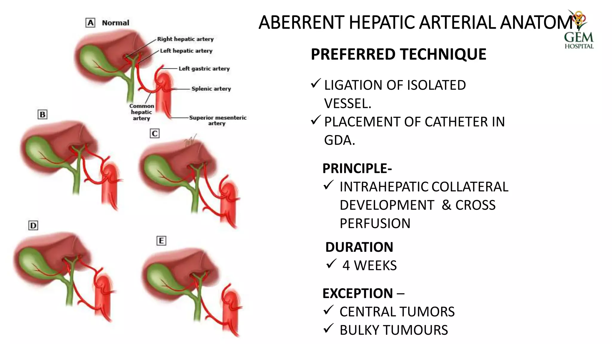 HEPATIC ARTERIAL INFUSION PUMP CHEMOTHERAPY IN HCC AND IHCC.pptx