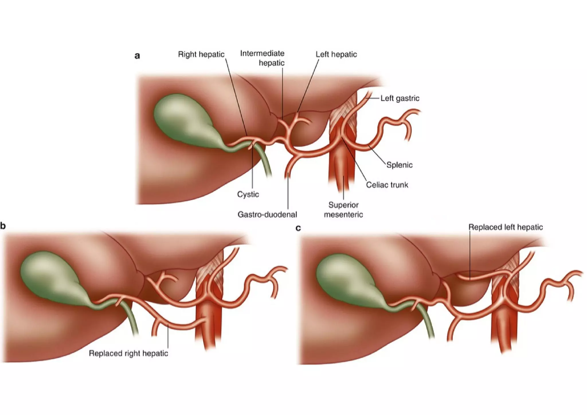 Hepatic Artery Varients Ppt