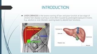 Hepatic/ Liver cirrhosis | PPTX