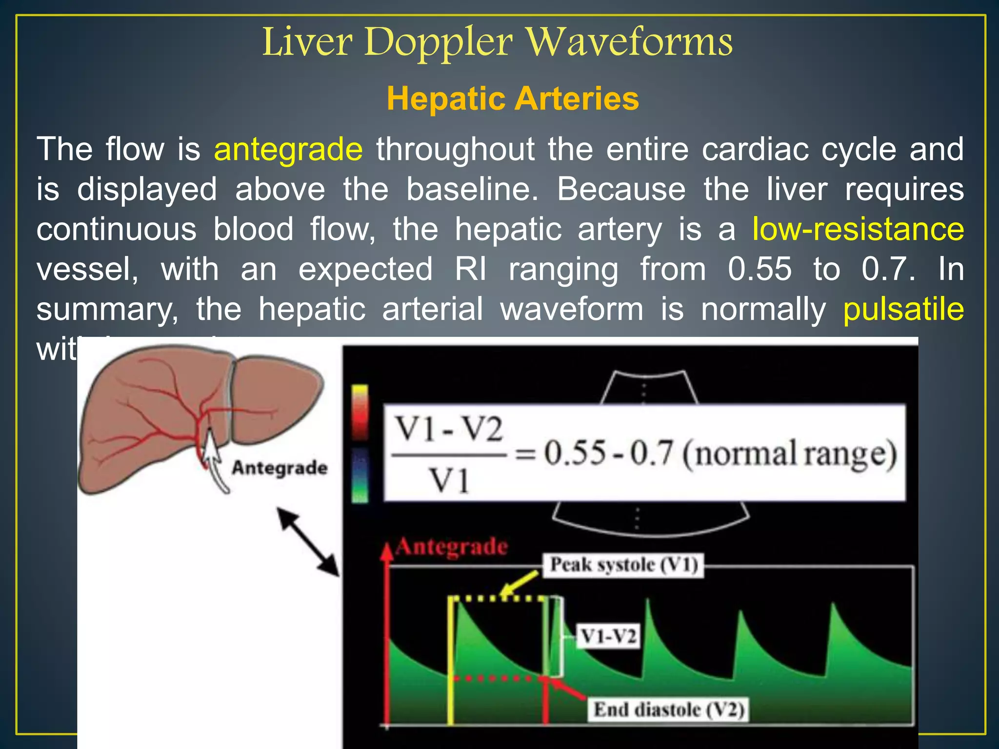 Hepatic doppler ultrasound | PPTX