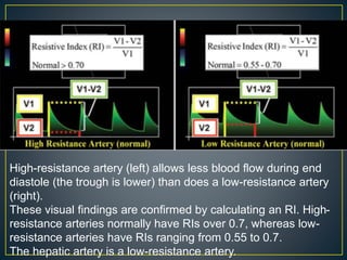 Hepatic doppler ultrasound | PPTX