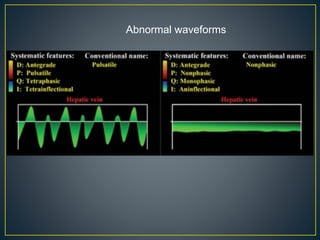 Hepatic doppler ultrasound | PPTX