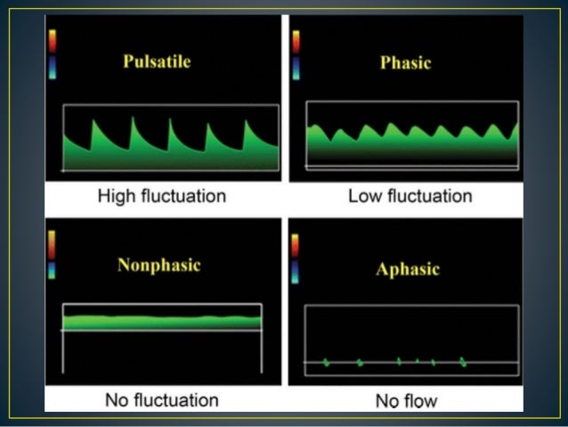 Hepatic doppler ultrasound