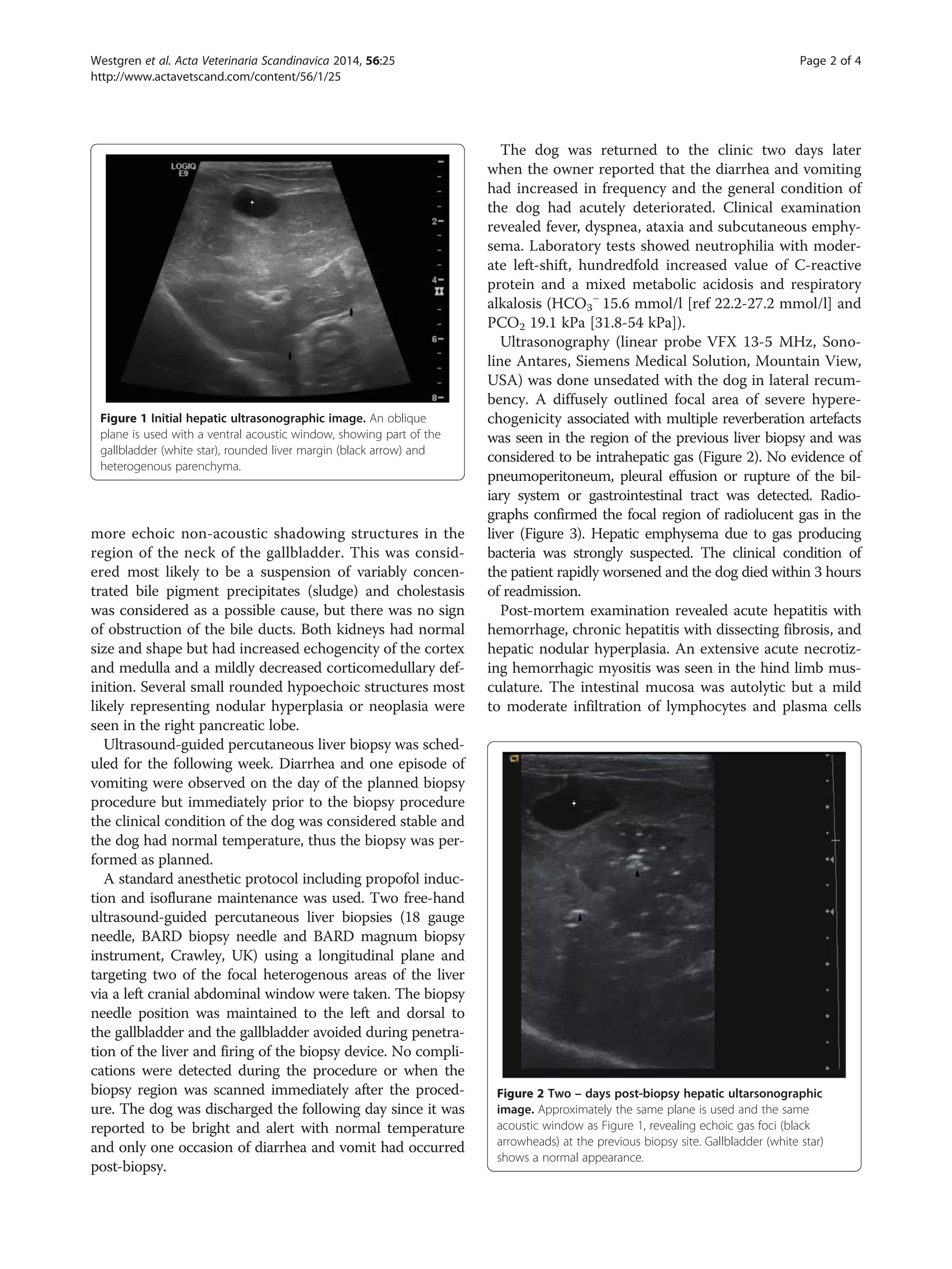 Hepatic emphysema associated with ultrasound-guided liver biopsy in a ...