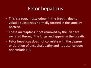 Fetor Hepaticus