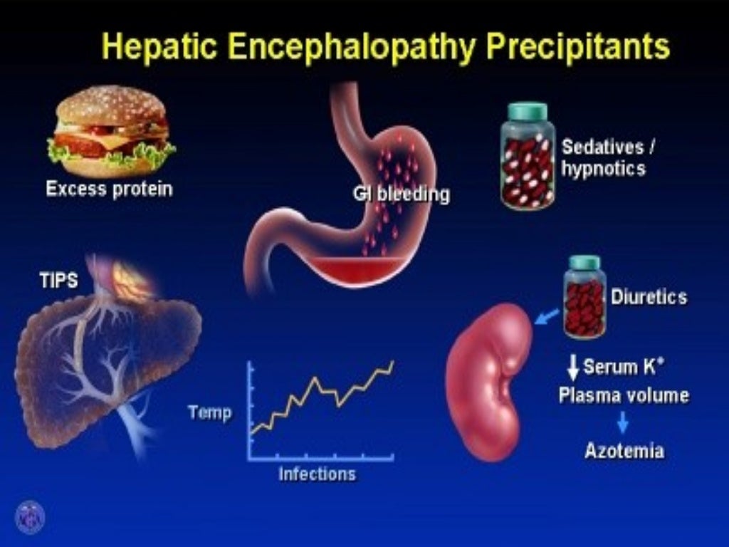 Hepatic encephalopathy, short review & update
