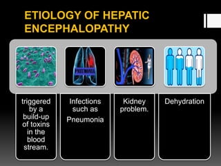 Hepatic encephalopathy | PPTX