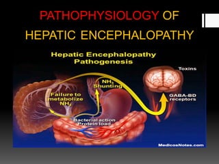 Hepatic encephalopathy | PPTX