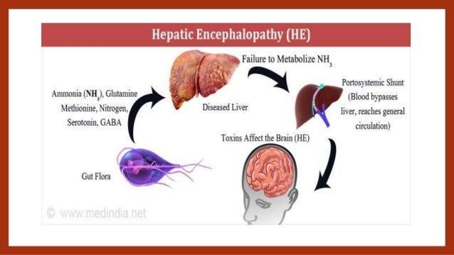Hepatische Encefalopathie