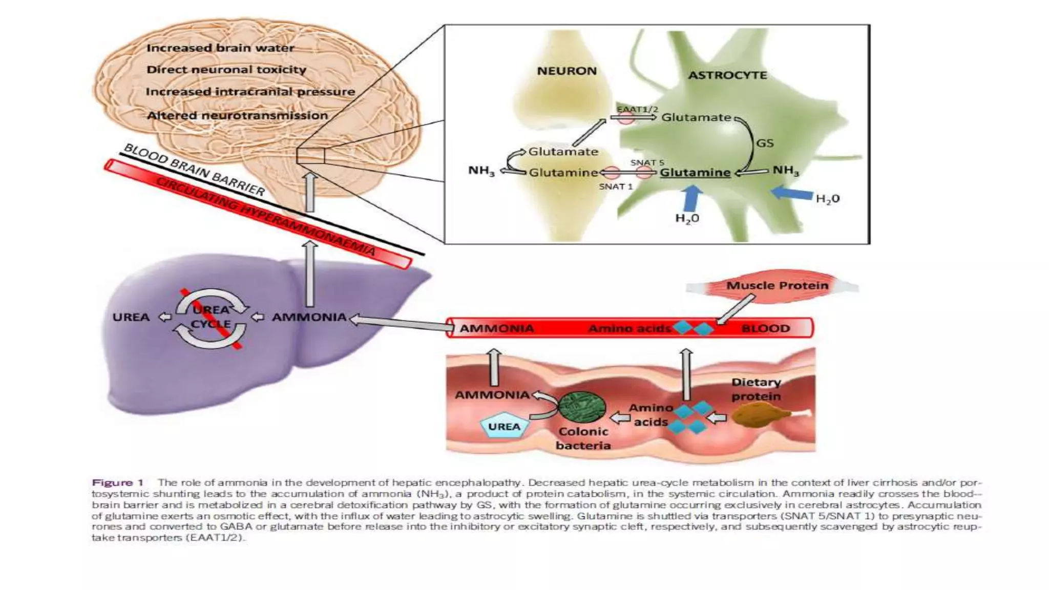 Hepatic encephalopathy | PPT
