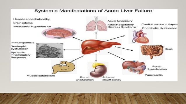 hepatic encephalopathy causes and treatment | PPTX | Blood Disorders ...