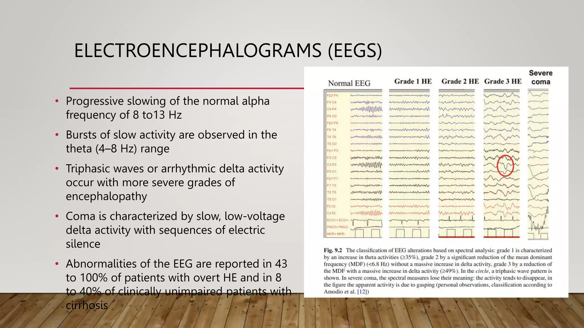 Hepatic encephalopathy-28-Sep-2023.pptx