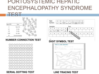 HEPATIC ENCEPHALOPATHY AND HEPATORENAL SYNDROME- DIAGNOSIS AND ...