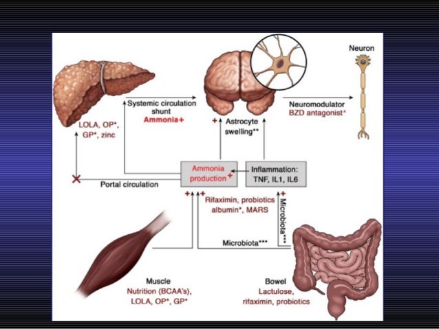 Hepatic Encephalopathy -Pathophysiology,Evaluation And Management