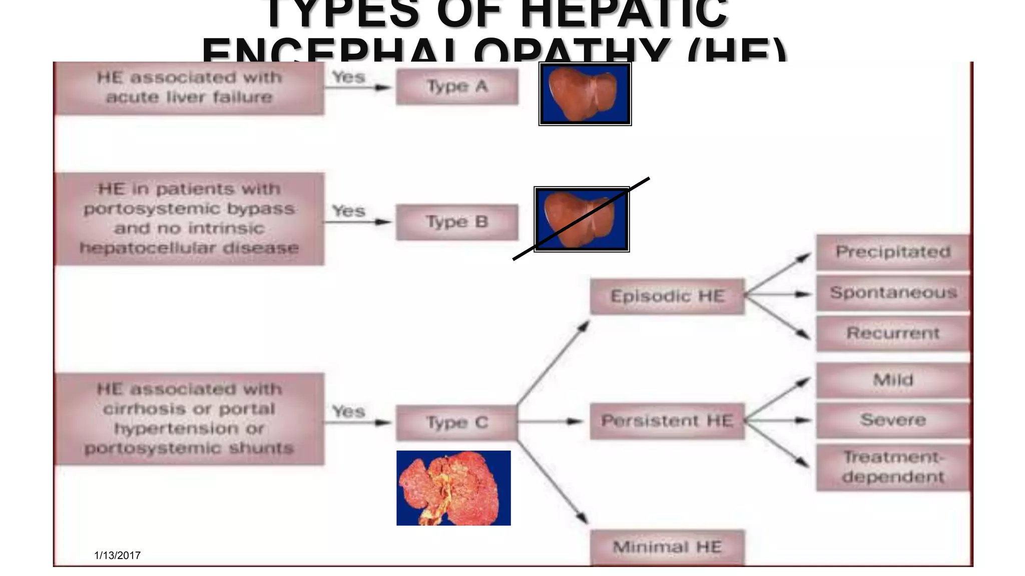 Hepatic encephalopathy symposium presentation | PPTX