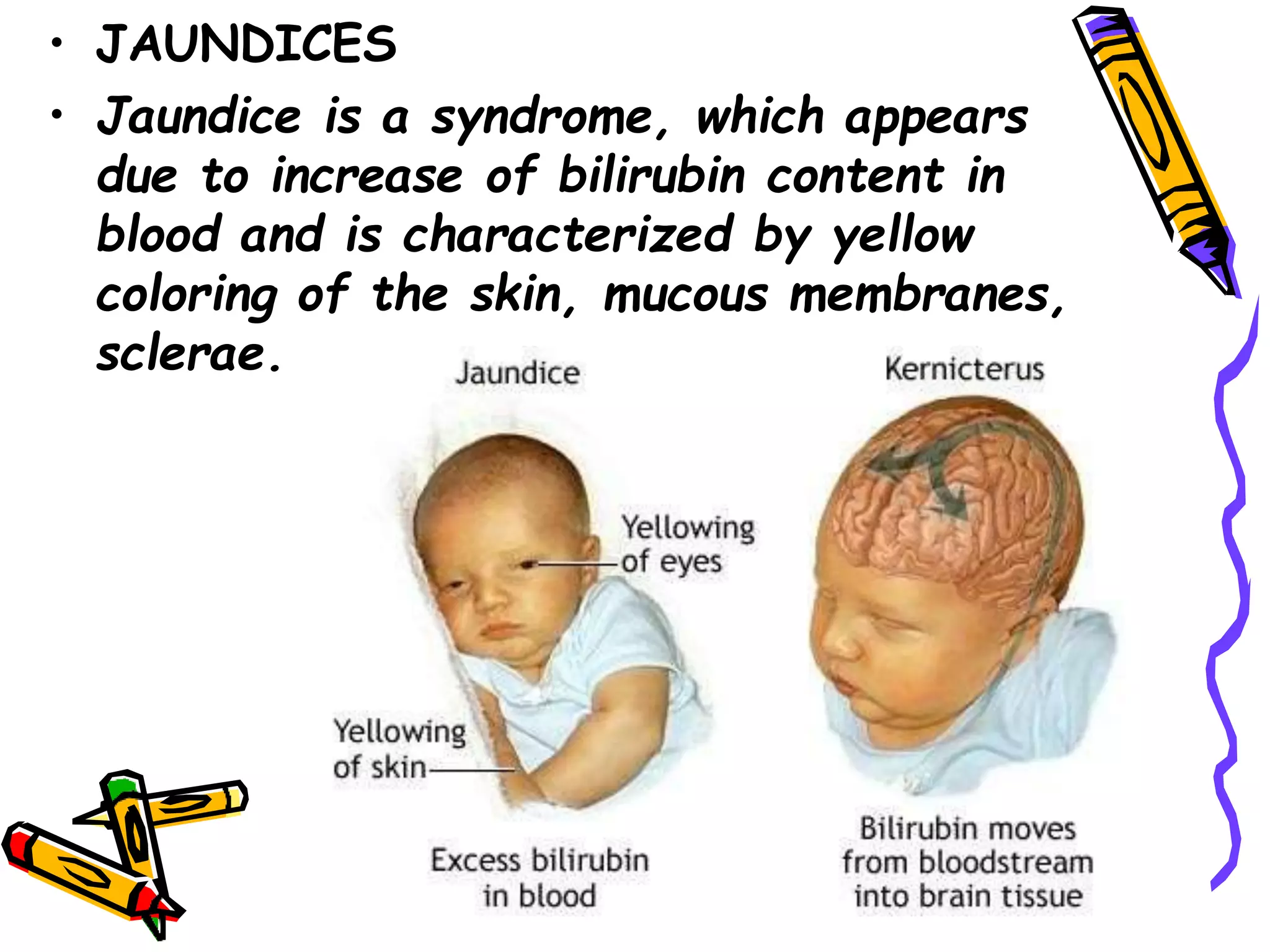 Hepatic Failure.pptx