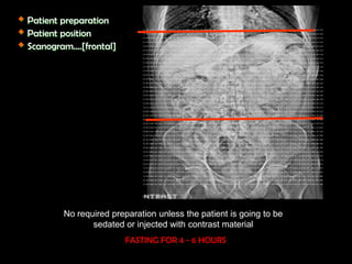 Hepatic imaging | PPTX