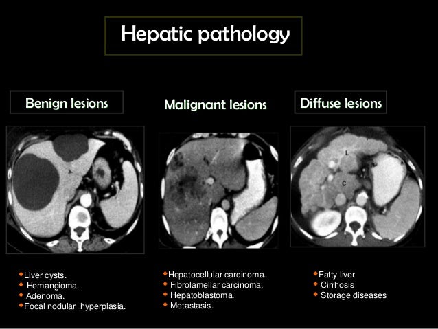 Hepatic imaging