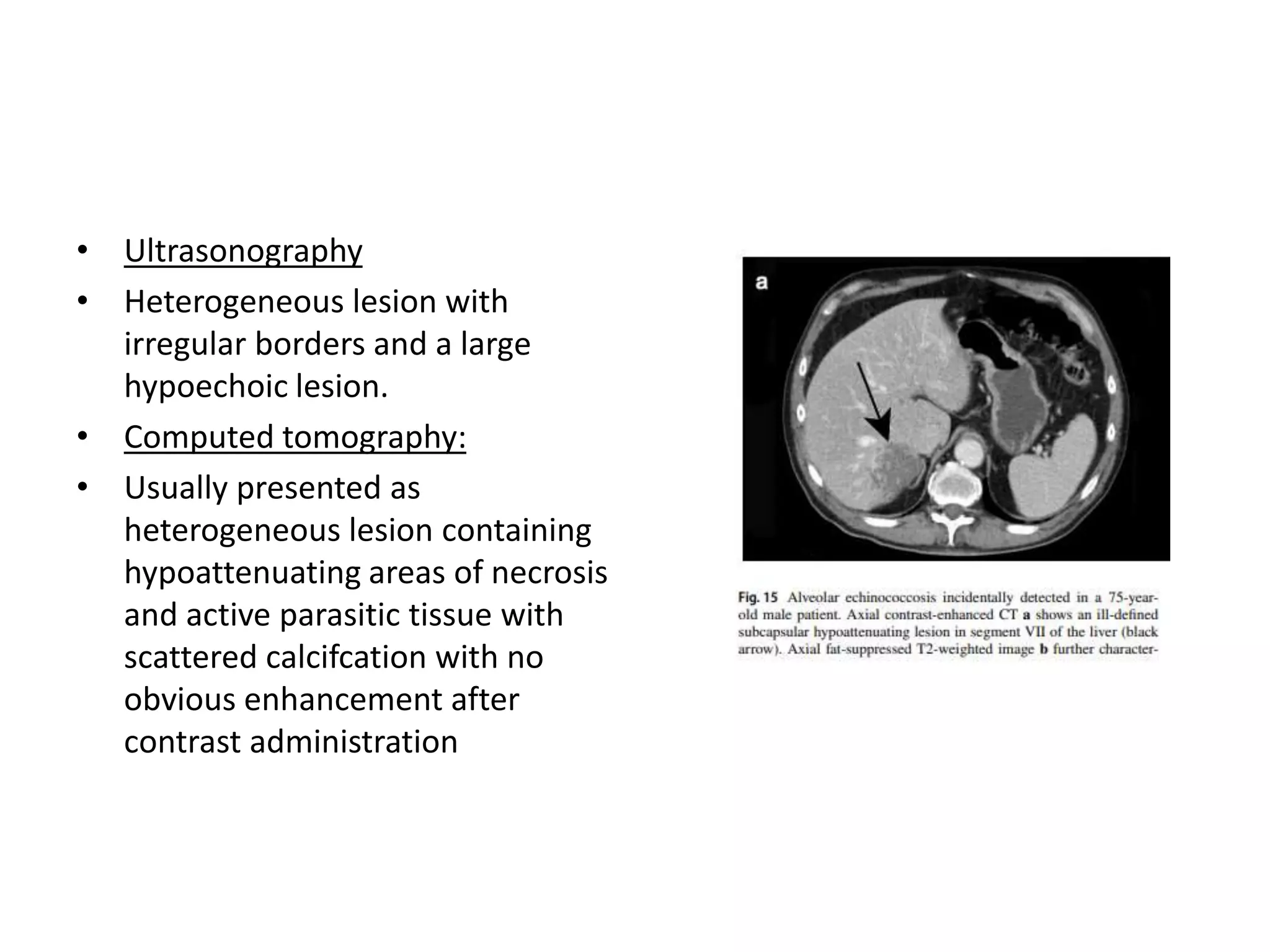 hepatic infections and inflammatory lesions VP (1).pptx