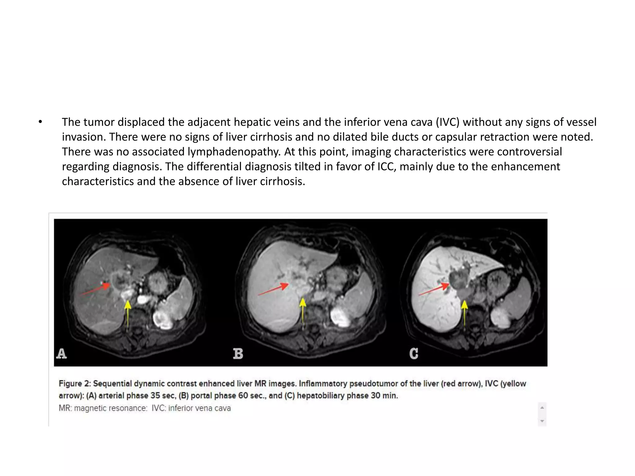 hepatic infections and inflammatory lesions VP (1).pptx
