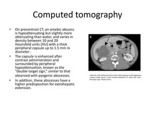 hepatic infections and inflammatory lesions VP (1).pptx