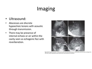 hepatic infections and inflammatory lesions VP (1).pptx
