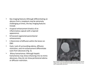 hepatic infections and inflammatory lesions VP (1).pptx