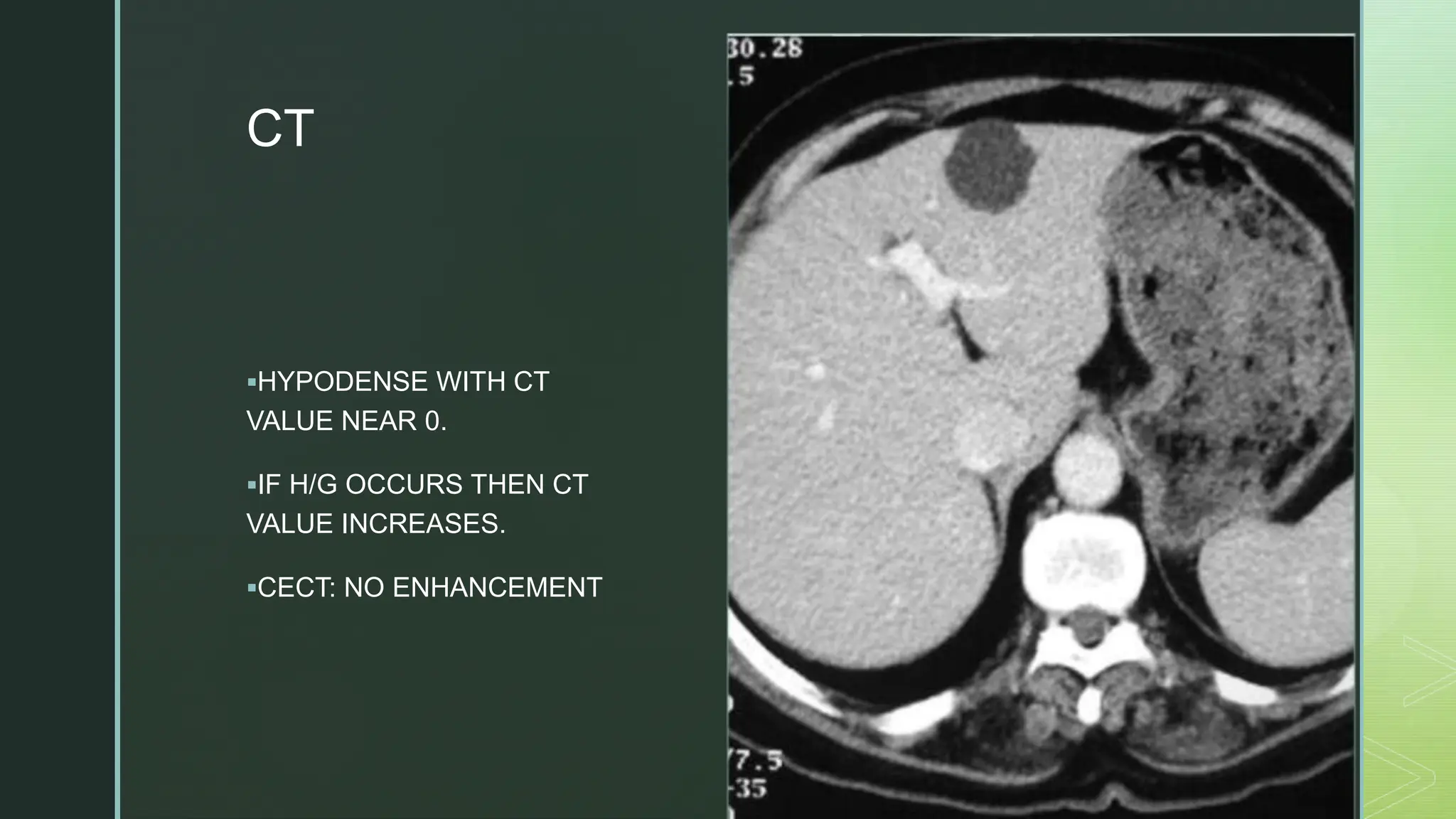 USG,CT AND MR IMAGING OF HEPATIC MASS LESIONS. | PPT