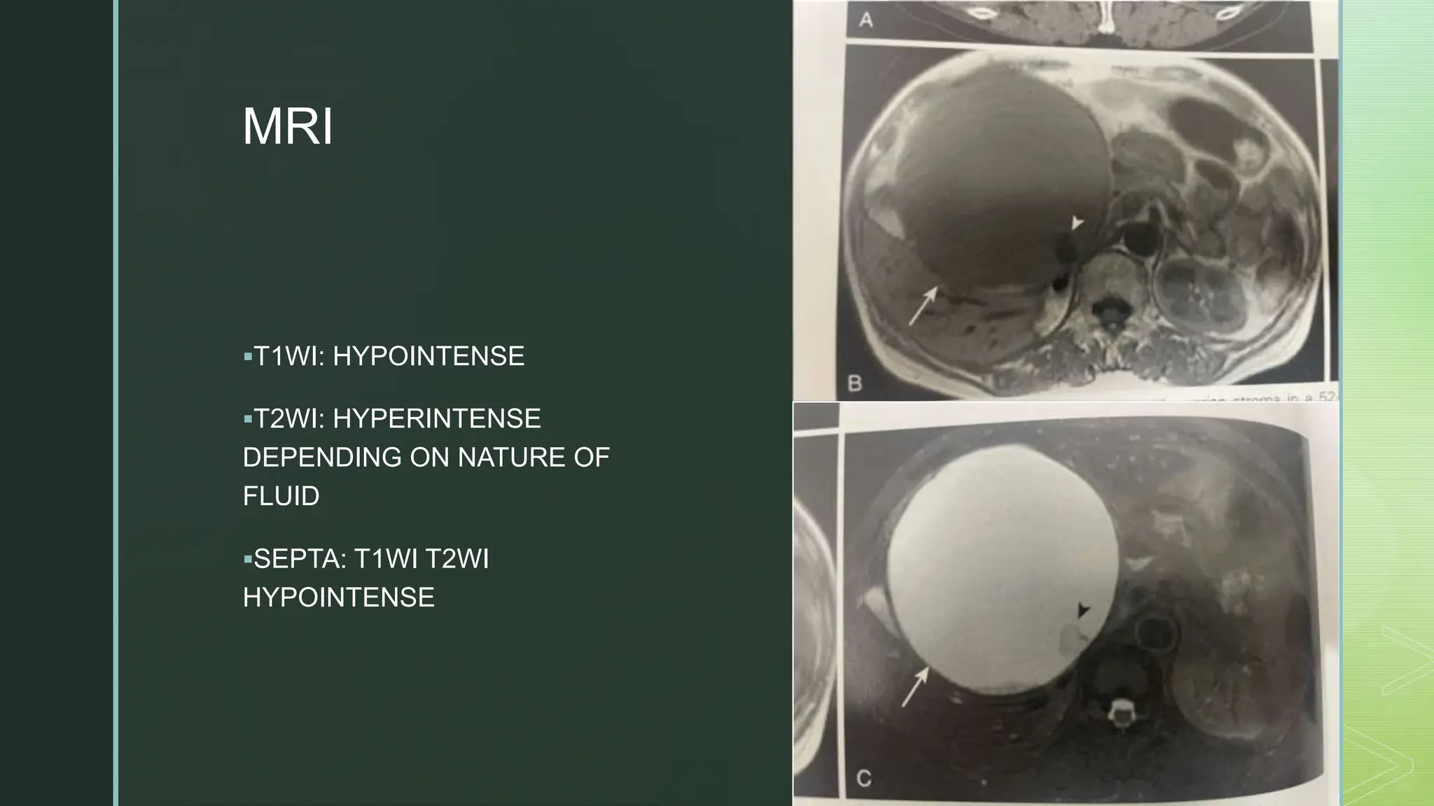 USG,CT AND MR IMAGING OF HEPATIC MASS LESIONS. | PPT