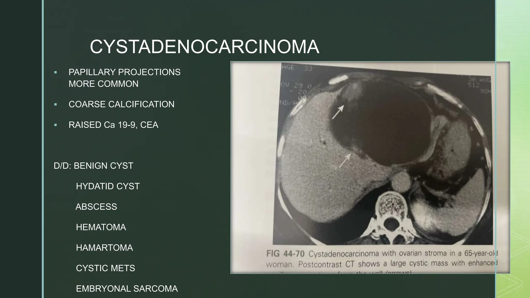 USG,CT AND MR IMAGING OF HEPATIC MASS LESIONS. | PPT