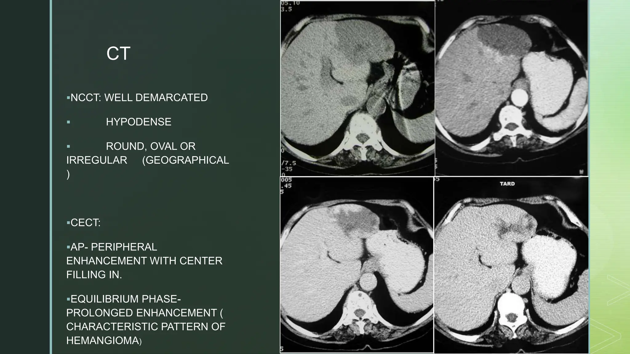 USG,CT AND MR IMAGING OF HEPATIC MASS LESIONS. | PPT