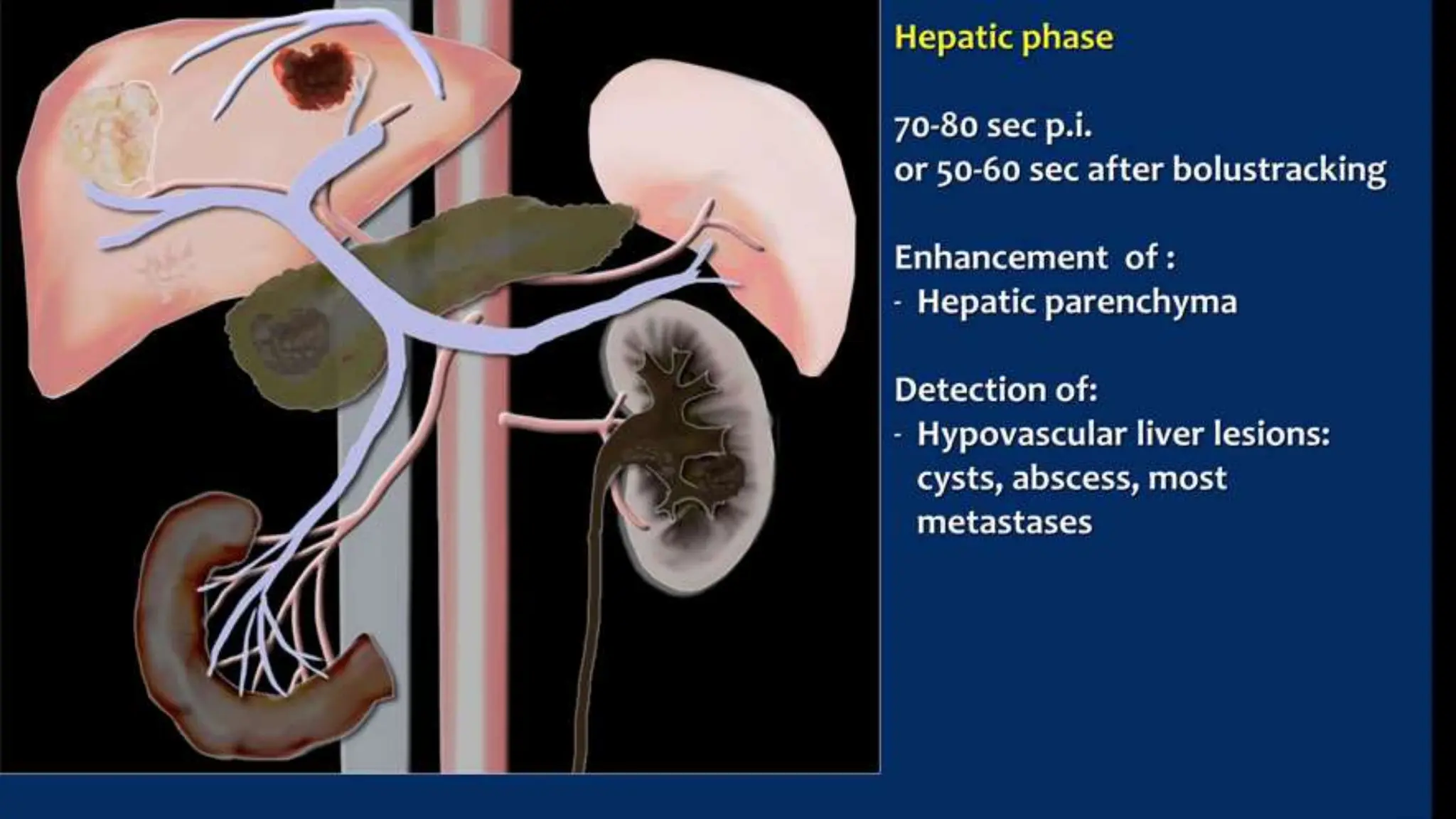 USG,CT AND MR IMAGING OF HEPATIC MASS LESIONS. | PPT