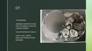USG,CT AND MR IMAGING OF HEPATIC MASS LESIONS. | PPTX