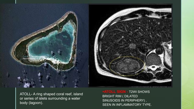 USG,CT AND MR IMAGING OF HEPATIC MASS LESIONS. | PPT
