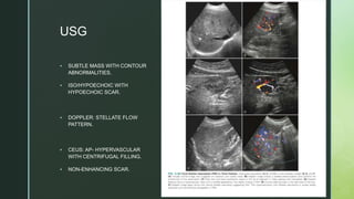 USG,CT AND MR IMAGING OF HEPATIC MASS LESIONS. | PPTX