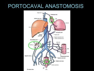 Hepatic portal system and portal hypertension | PPTX
