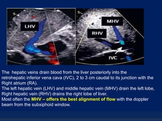 Hepatic veins - The Doppler interrogation | PPTX